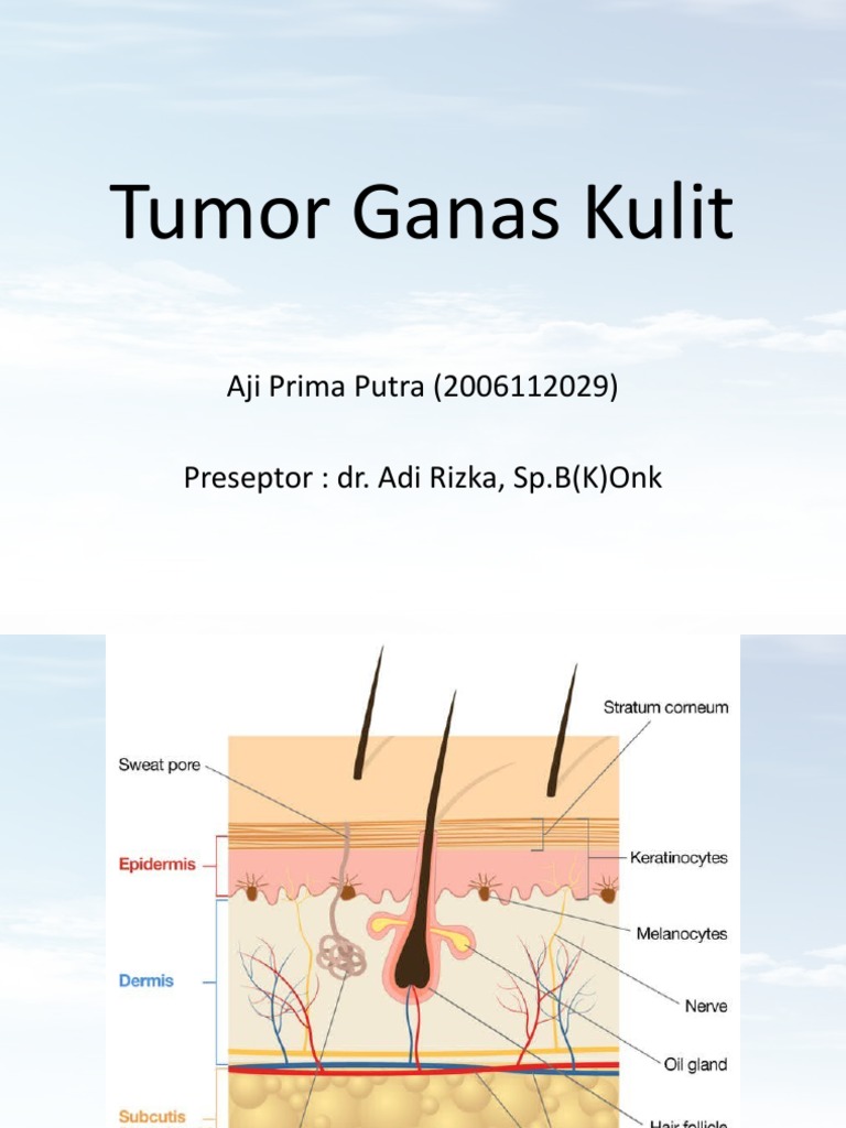 Understanding Skin Cancers | PDF | Melanoma | Skin Cancer