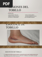 Proceso de Stieda y su tratamiento | PDF | Tobillo | Cirugía