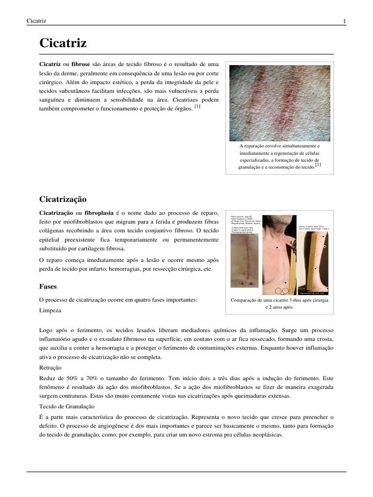 Cicatriz | PDF | Endotélio | Matriz extracelular