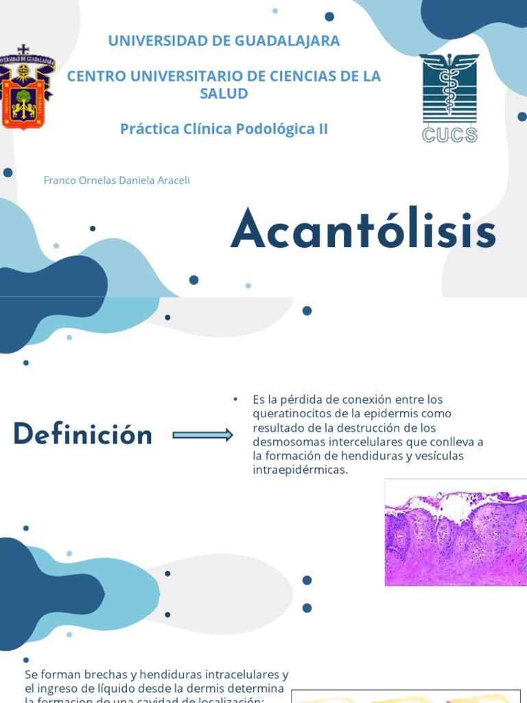 ACANTOLISIS | PDF | Piel | Epidemiología