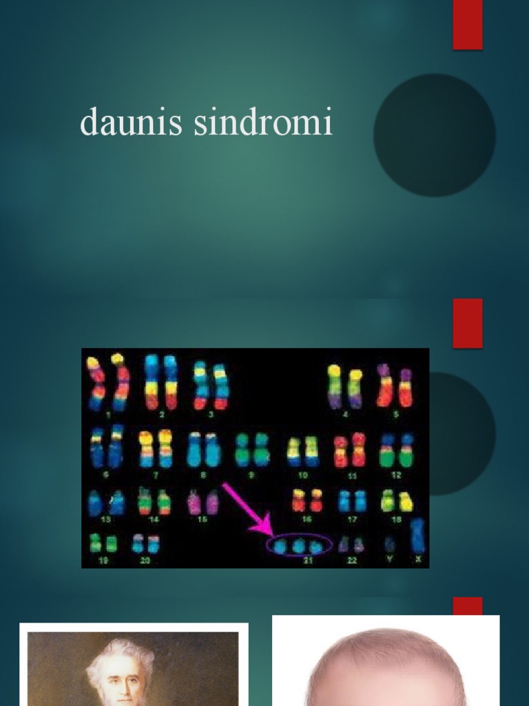 Analisis Daunis Sindromi dan Fenotip | PDF | Kesehatan Holistik | Sains ...