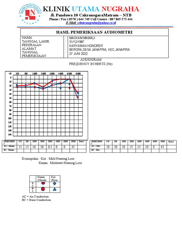 Hasil Pemeriksaan Audiometri | PDF