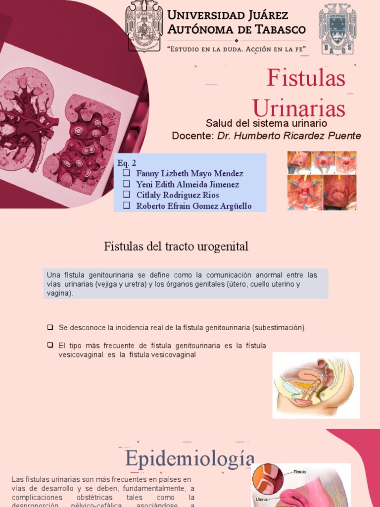 Fistulas Urinarias | PDF | Vejiga urinaria | Cicatrización de la herida