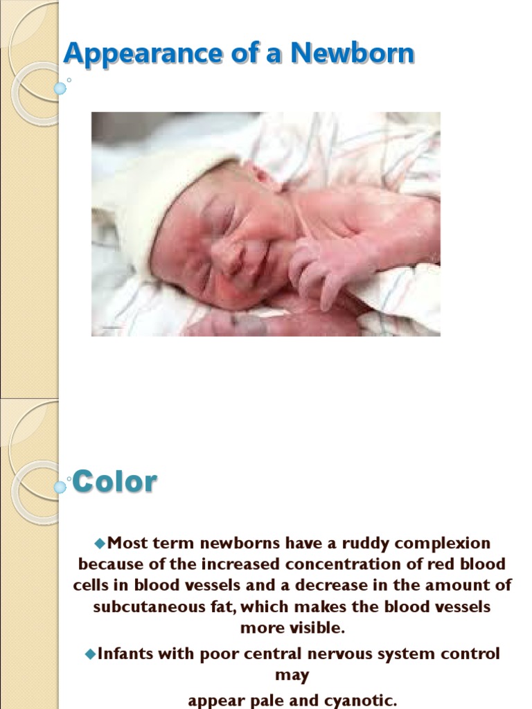 Appearance of A Newborn | PDF | Clinical Medicine | Medical Specialties