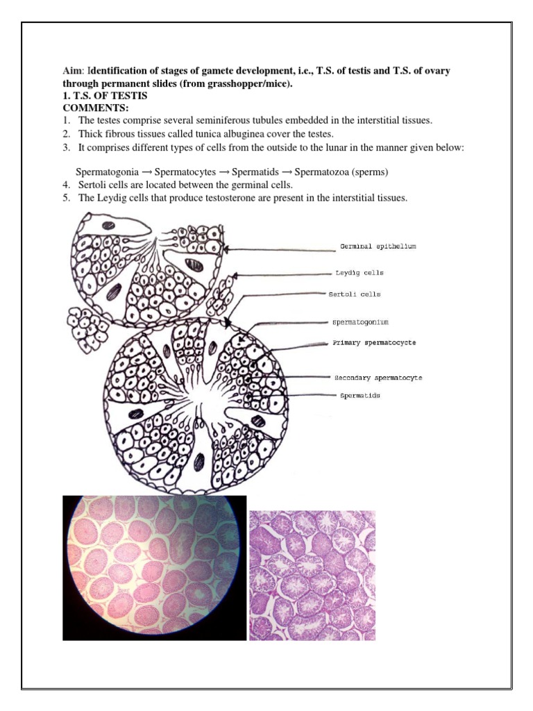 T.S. of Testis and Ovary Analysis | PDF