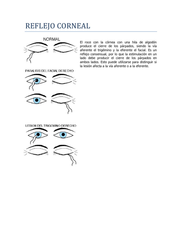 Reflejo Corneal