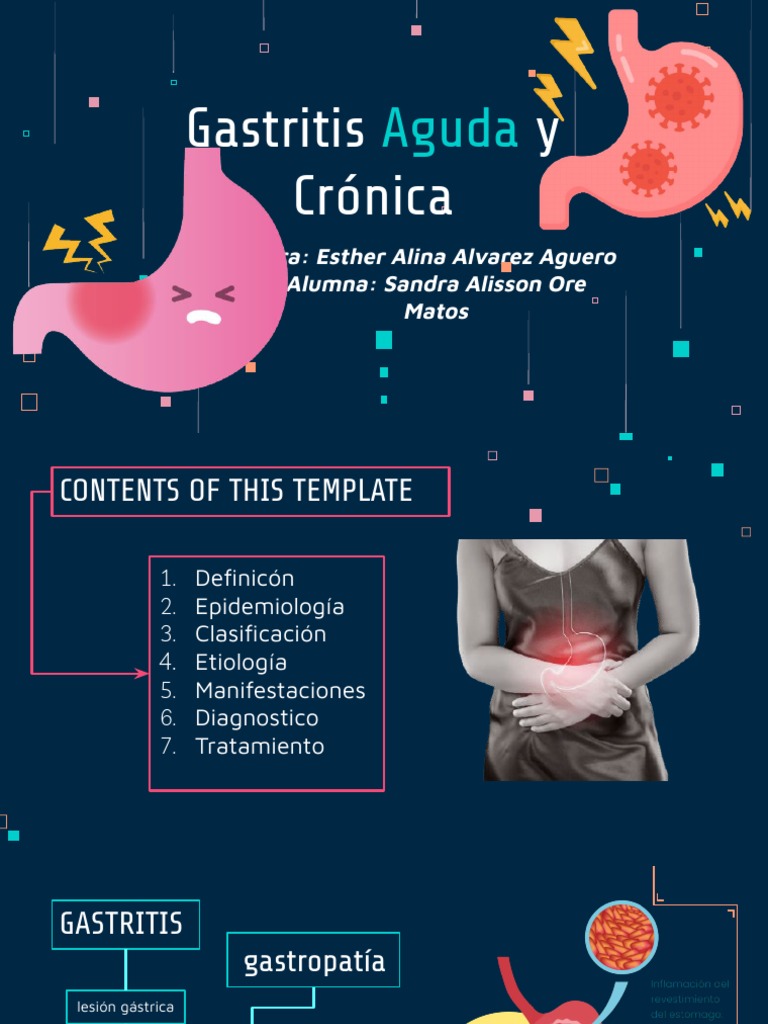 Gastritis Aguda Y Crónica Clasificación Y Tratamiento Pdf