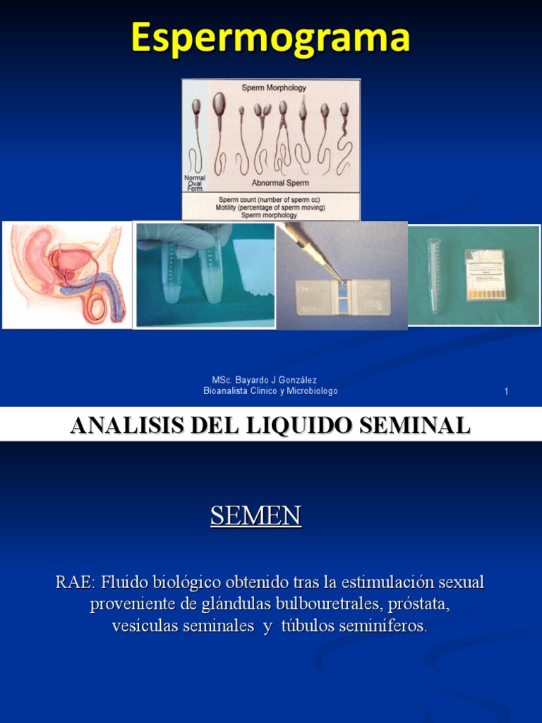 Clase Espermograma | PDF | Semen | Eyaculación