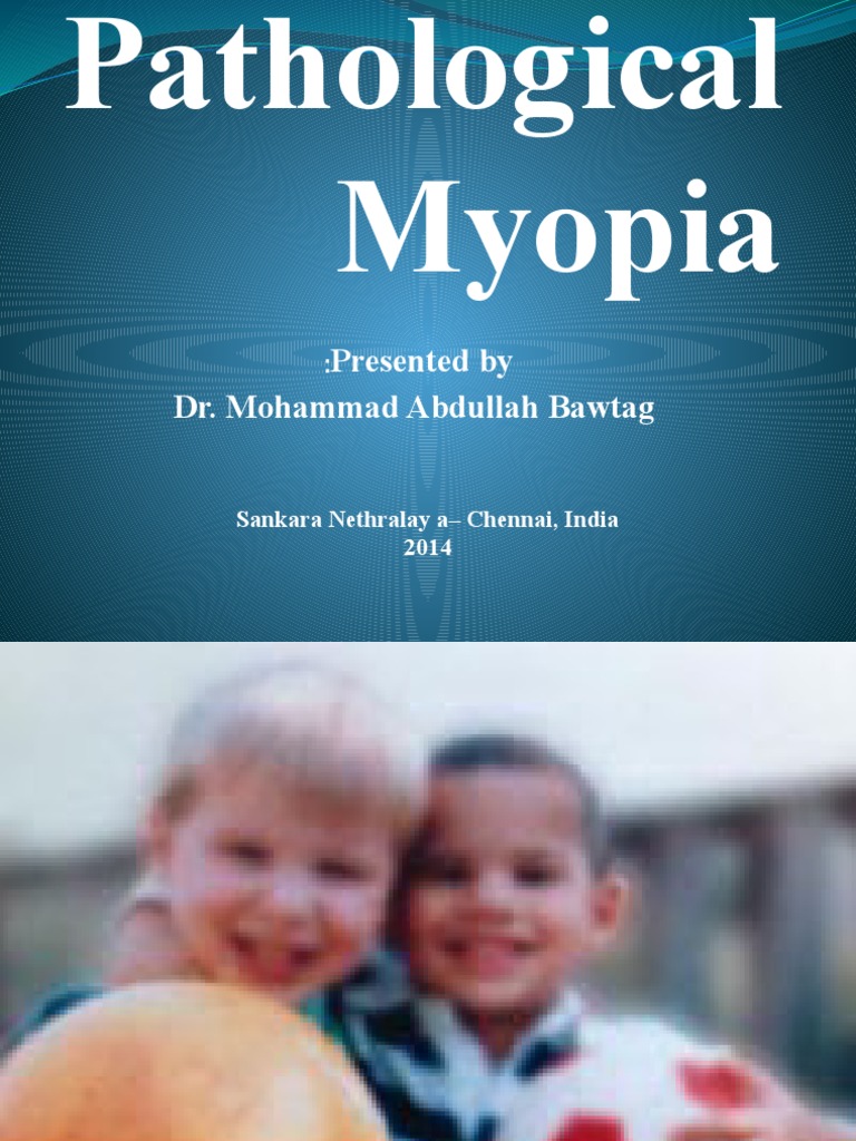 Pathological Myopia | PDF | Myopia | Visual System