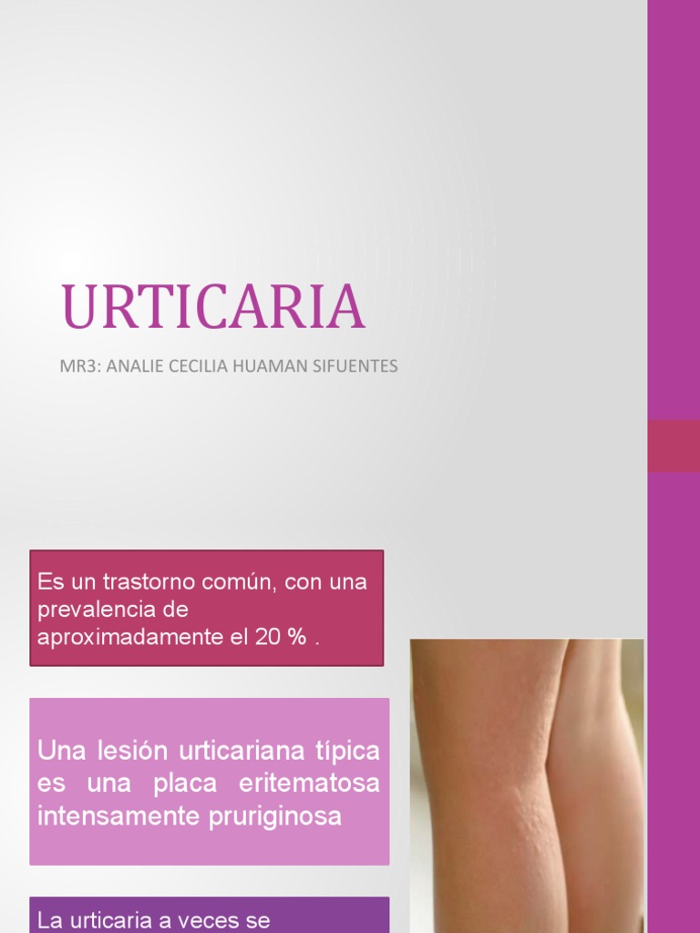 Urticaria - Residente | PDF | Alergia | Medicina CLINICA