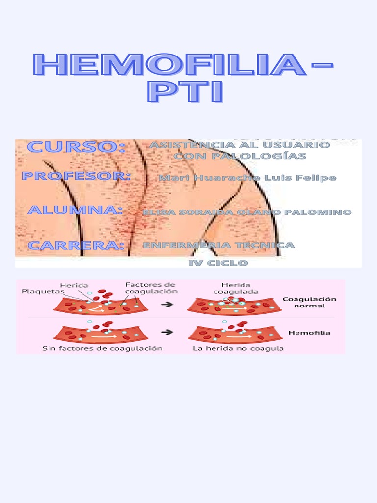 Hemofilia PTI | PDF | Hemofilia | Enfermedades y trastornos humanos