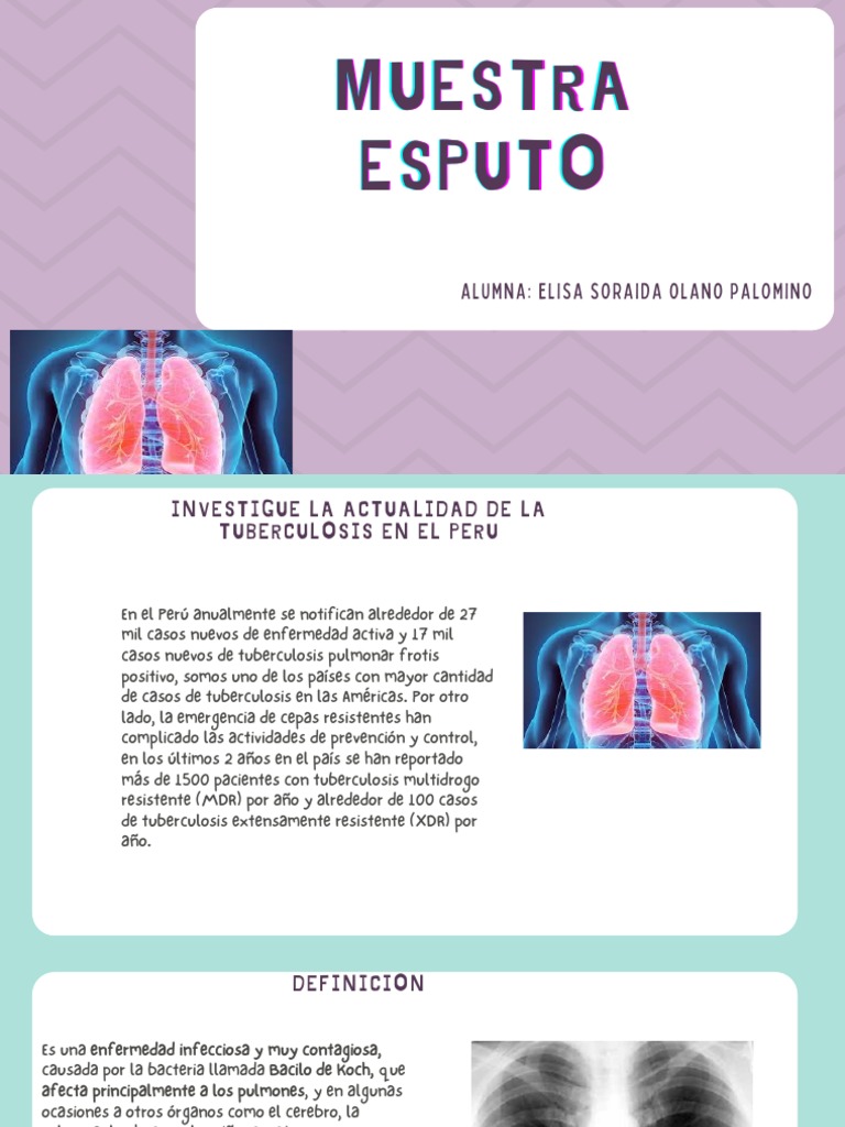 Prueba de Esputo | PDF | Tuberculosis | Mycobacterium