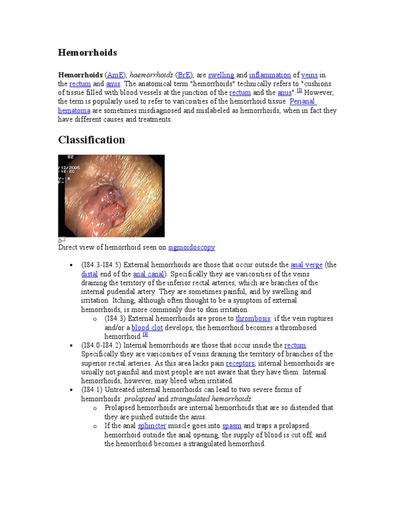 Hemorrhoids | PDF | Hemorrhoid | Constipation
