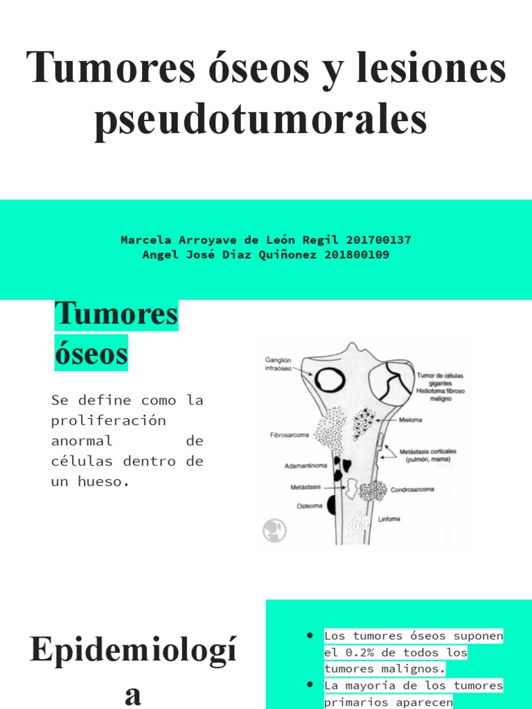 Tumores Óseos y Lesiones Pseudotumorales - Marcela Arroyave de León Regil 4 | PDF | Hueso | Cáncer