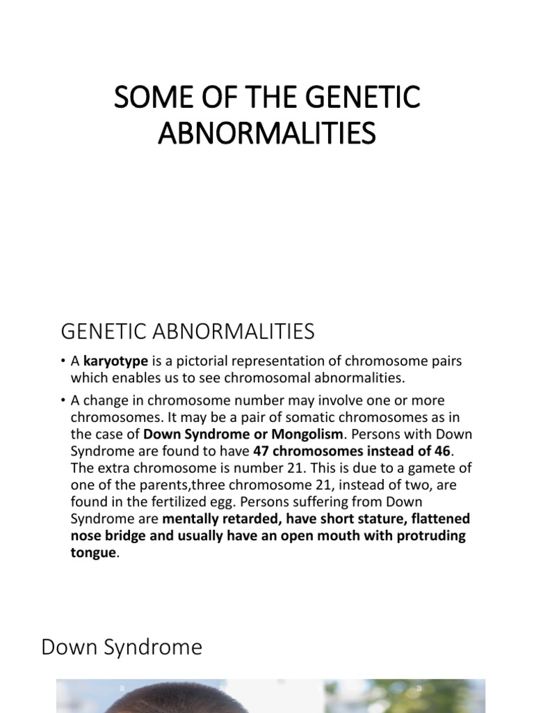 Some of The Genetic Abnormalities | PDF | Genetic Disorder | Cell Nucleus