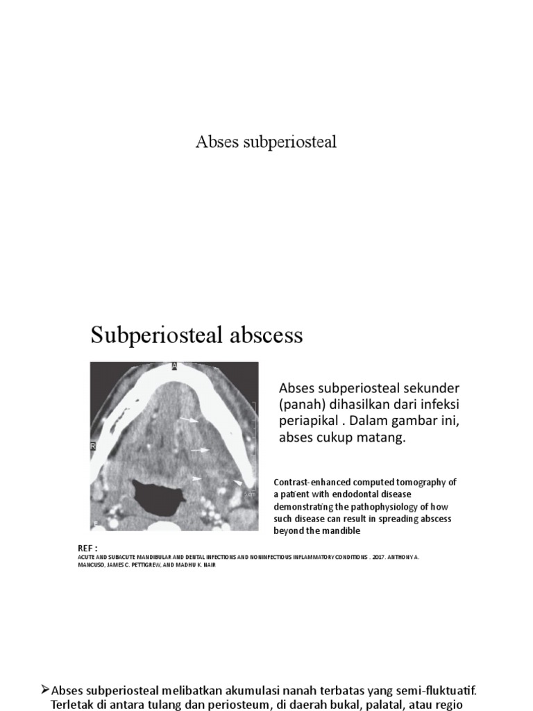 Abses Subperiosteal | PDF