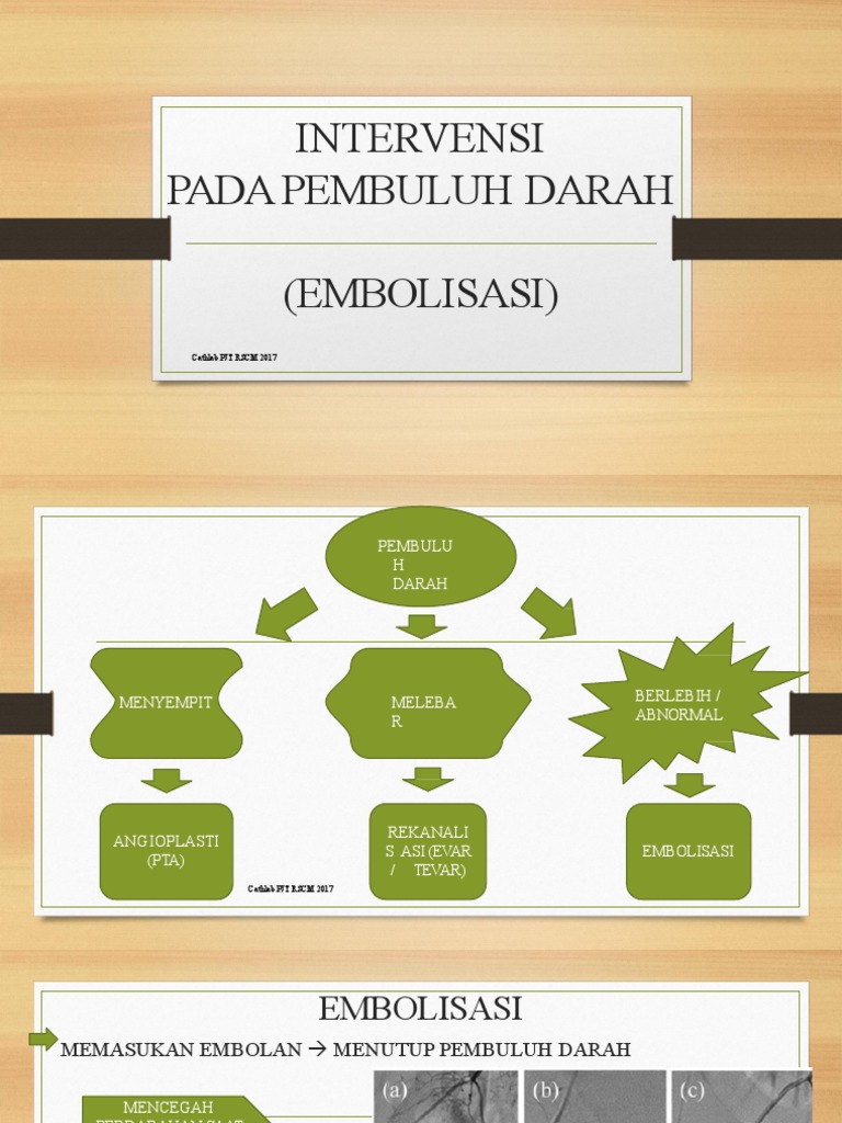 Intervensi Pada Pembuluh Darah (Embolisasi) | PDF | Medical Procedures ...