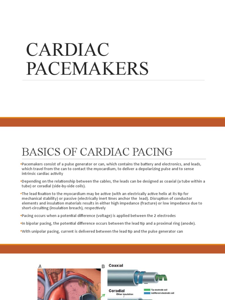 Pacemakers | Download Free PDF | Artificial Cardiac Pacemaker ...