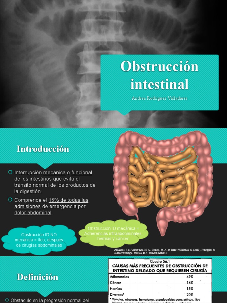 Obstrucción Intestinal | PDF | Causas de la muerte | Enfermedades y ...