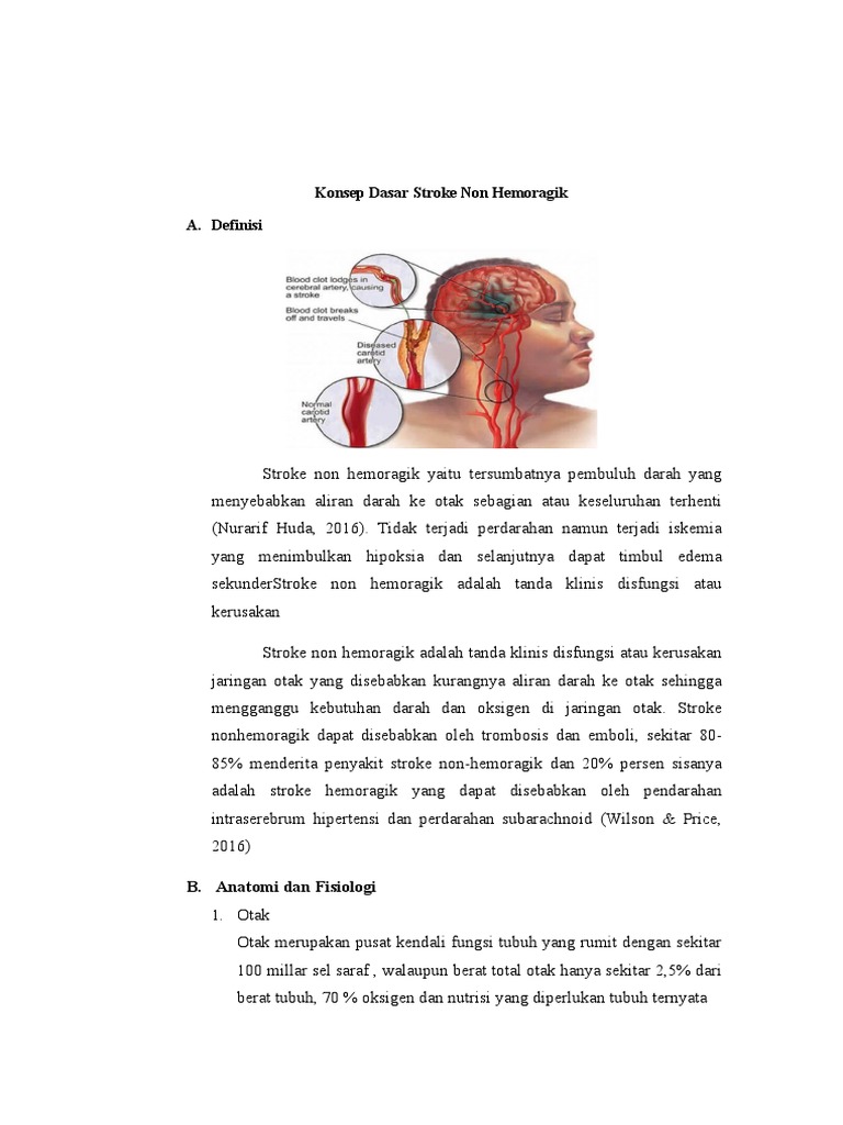 LP Stroke Non Hemoragik | PDF