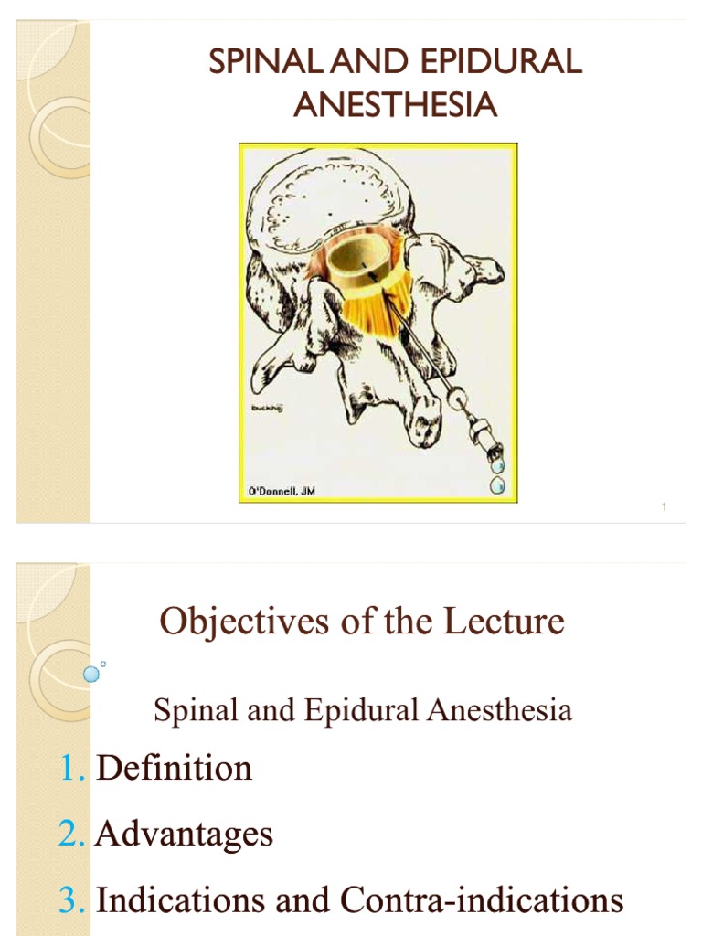 Epidural vs Spinal Anesthesia Guide | PDF | Anesthesia | Surgery
