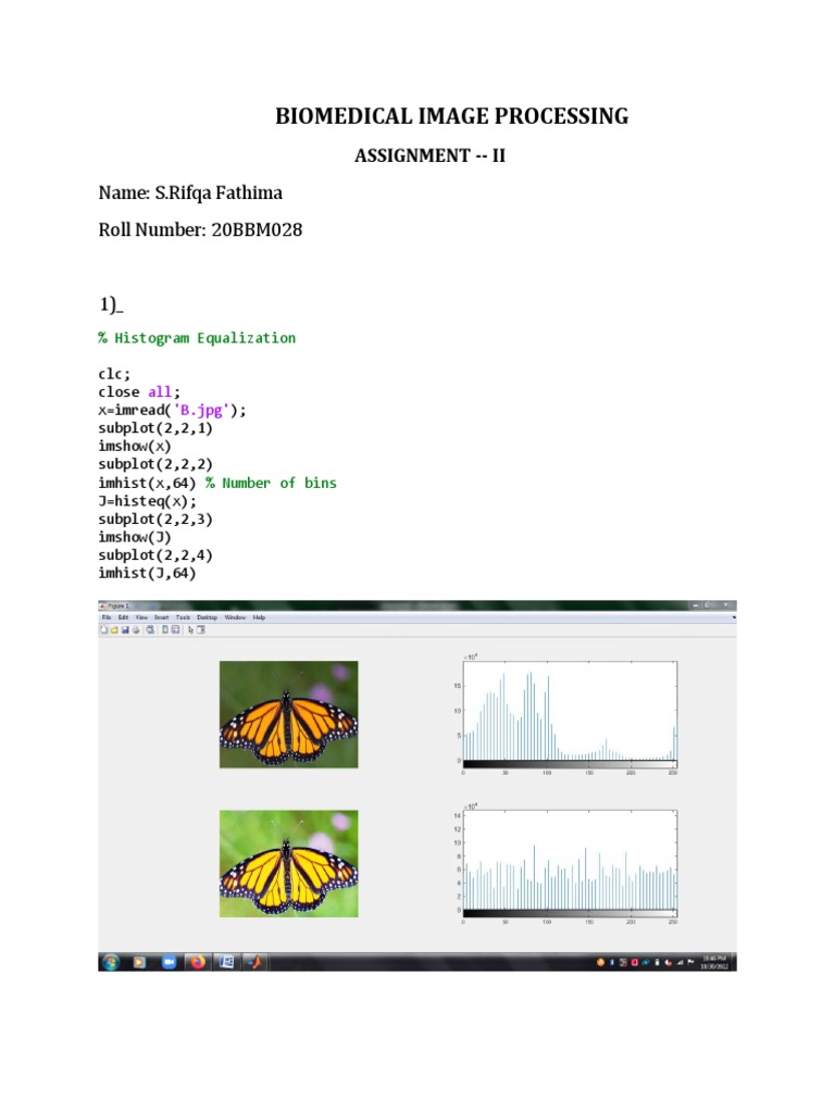 Digital Image Processing Pdf Multidimensional Signal Processing Recording 