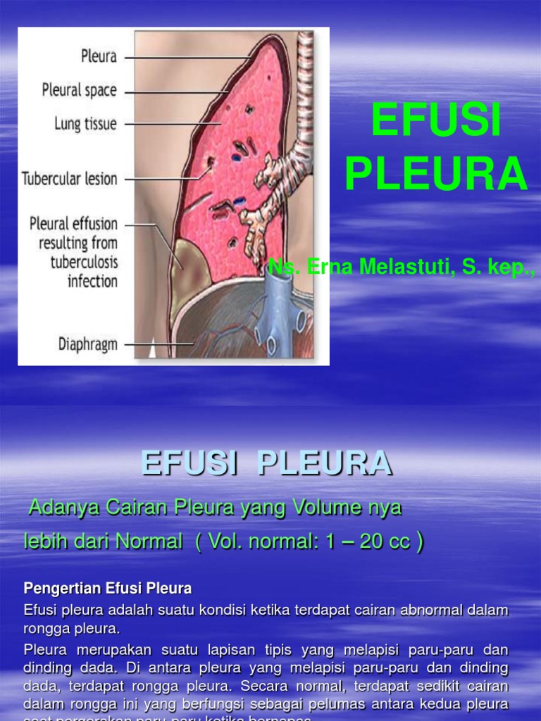 1 Handout Effusi Pleura | PDF
