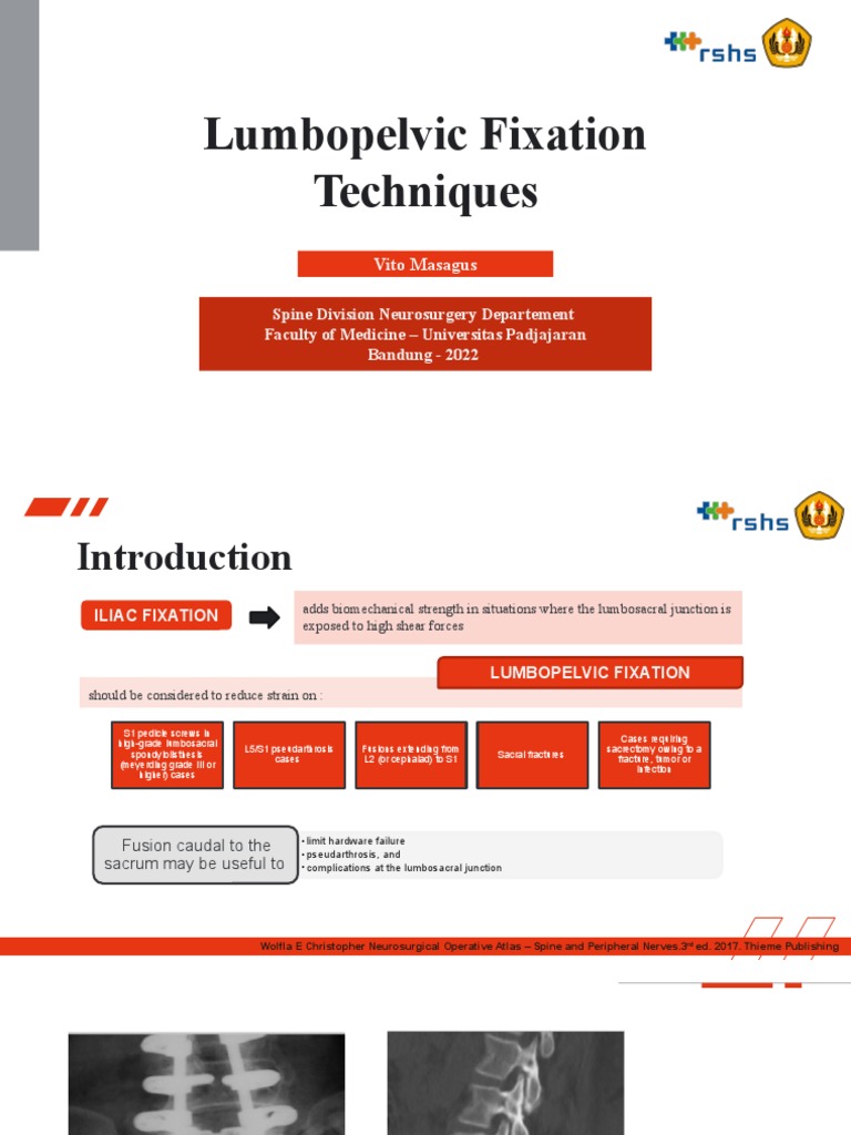 ISMT 12 - Day 383 - Vito - Lumbopelvic Fixation Techniques | PDF ...