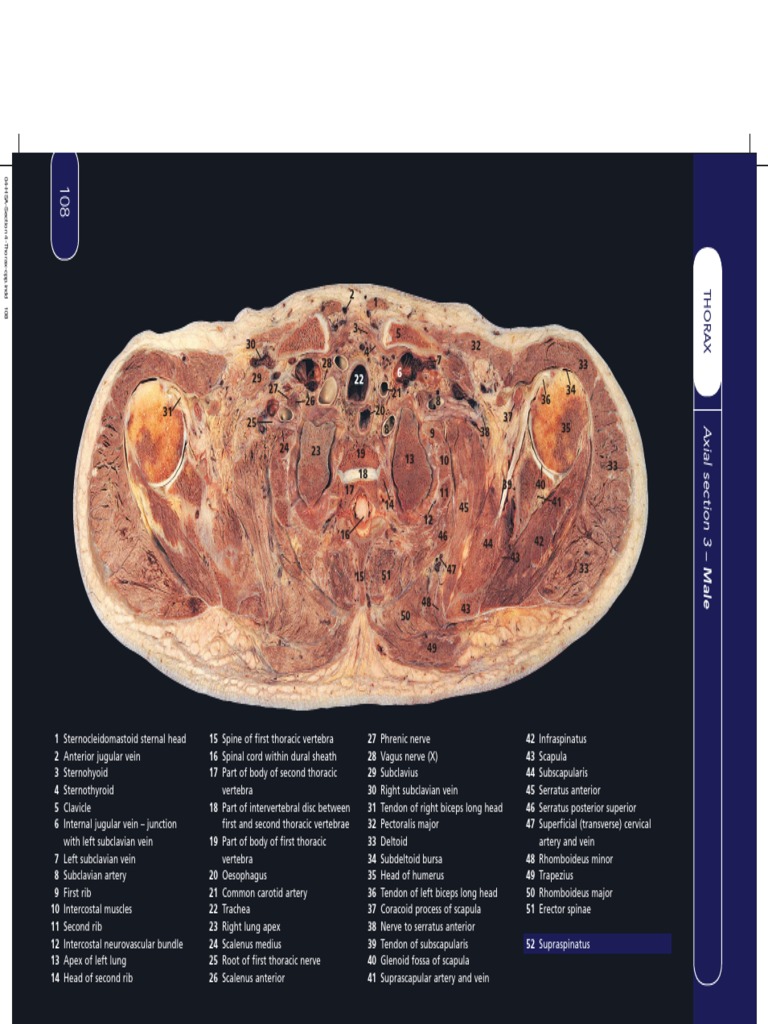 Human Sectional Anatomy Atlas of Body Sections, CT and MRI Images 4ed-127-201 | PDF | Thorax ...