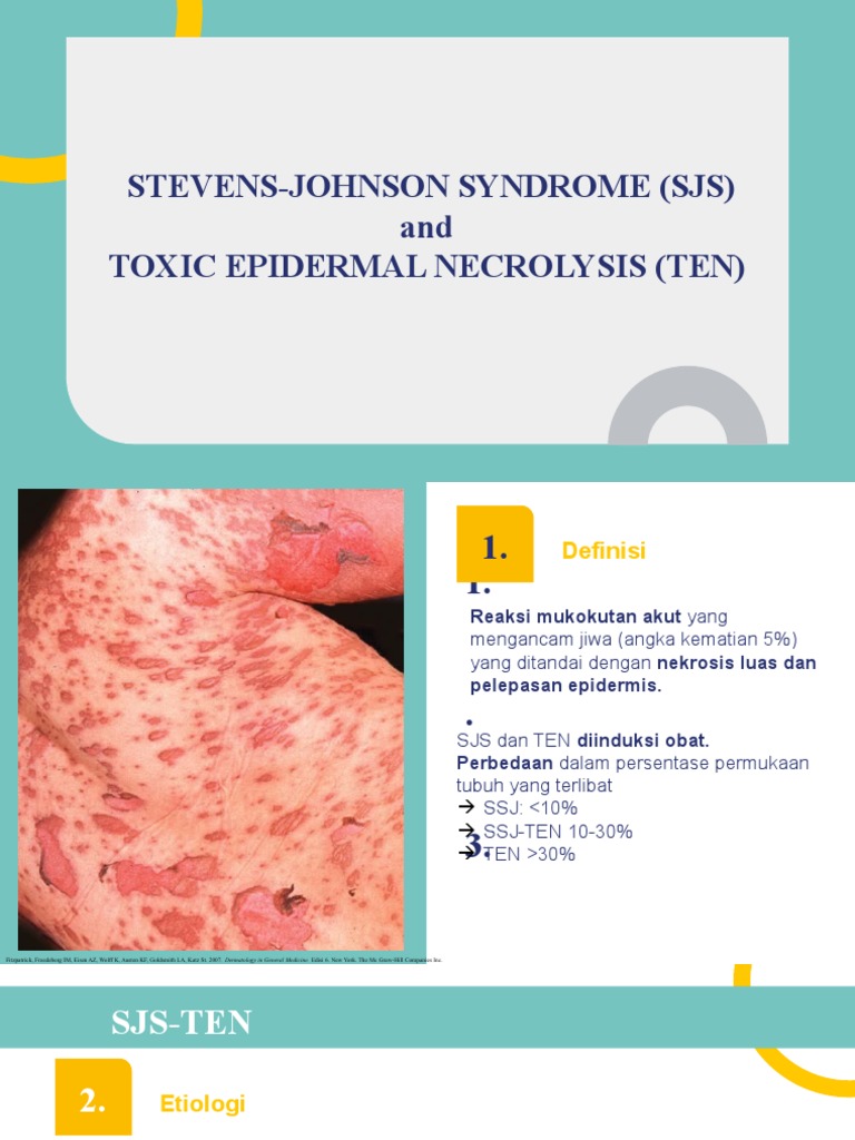 SJS Ten | PDF