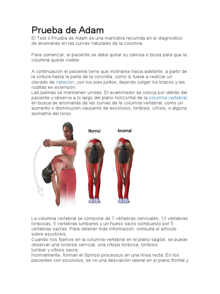 Prueba de Adam para Diagnóstico de Escoliosis | PDF