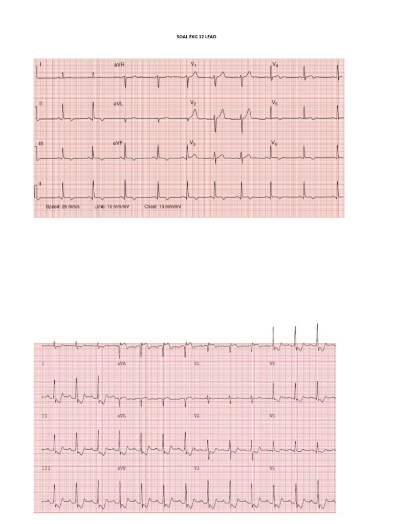 Skill Station EKG | PDF