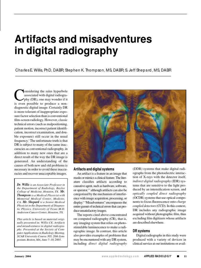 Artifacts and Misadventures in Digital Radiography | Radiology ...
