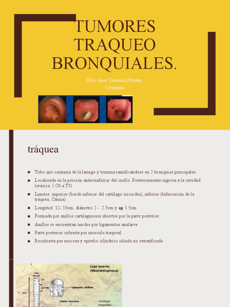 Tumores Traqueo Bronquiales Orginal | PDF | Cáncer | Metástasis