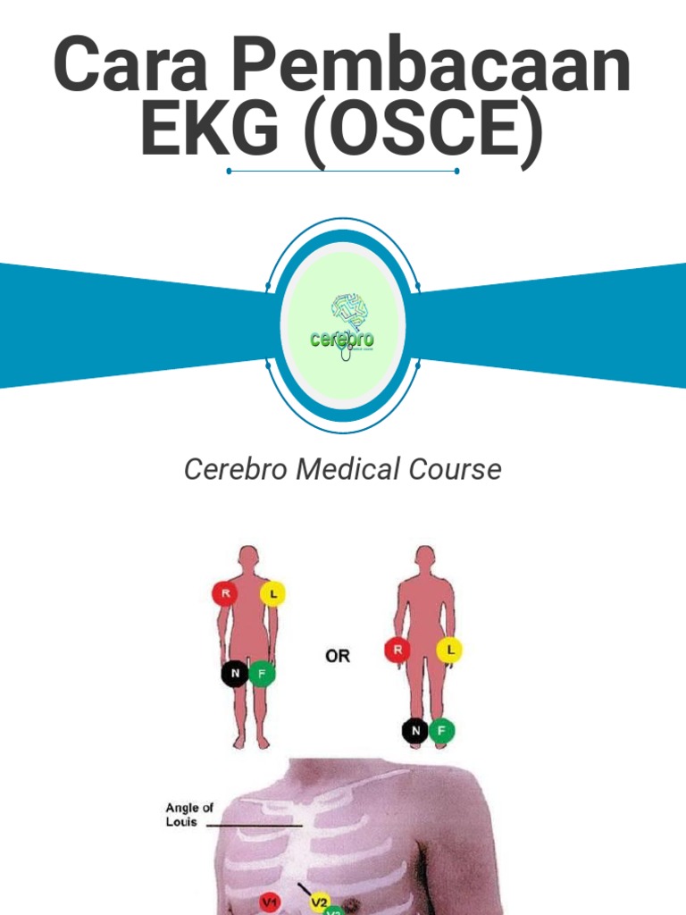 Cara Membaca Ekg | PDF