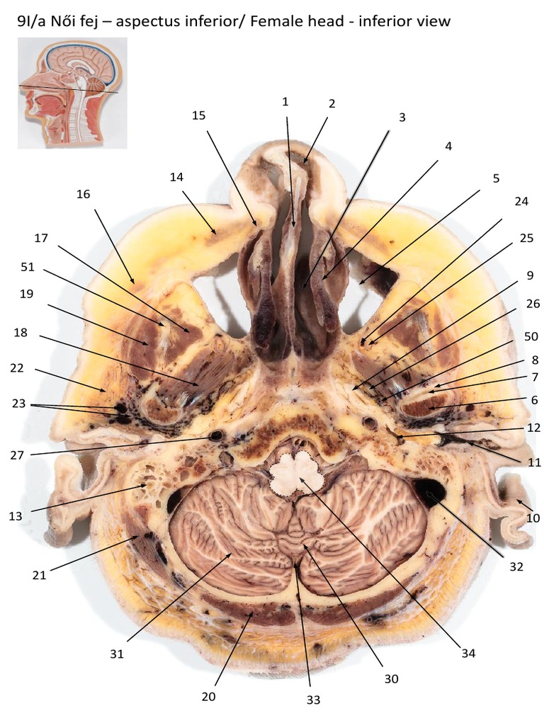 Metszetanatómia Női Fej És Nyak | PDF | Common Carotid Artery | Neck
