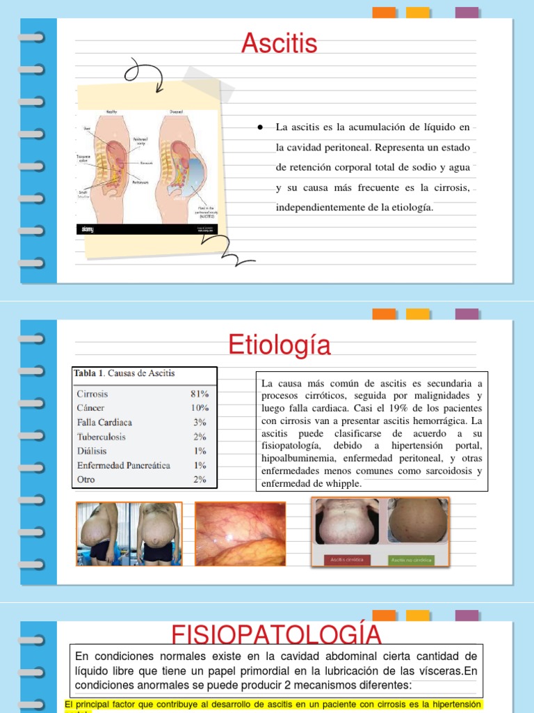ASCITIS | PDF | Cirrosis | Ciencias de la Salud