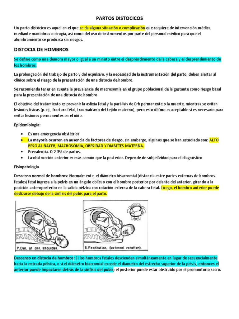 Manejo de Partos Distócicos | PDF | Parto | Pelvis