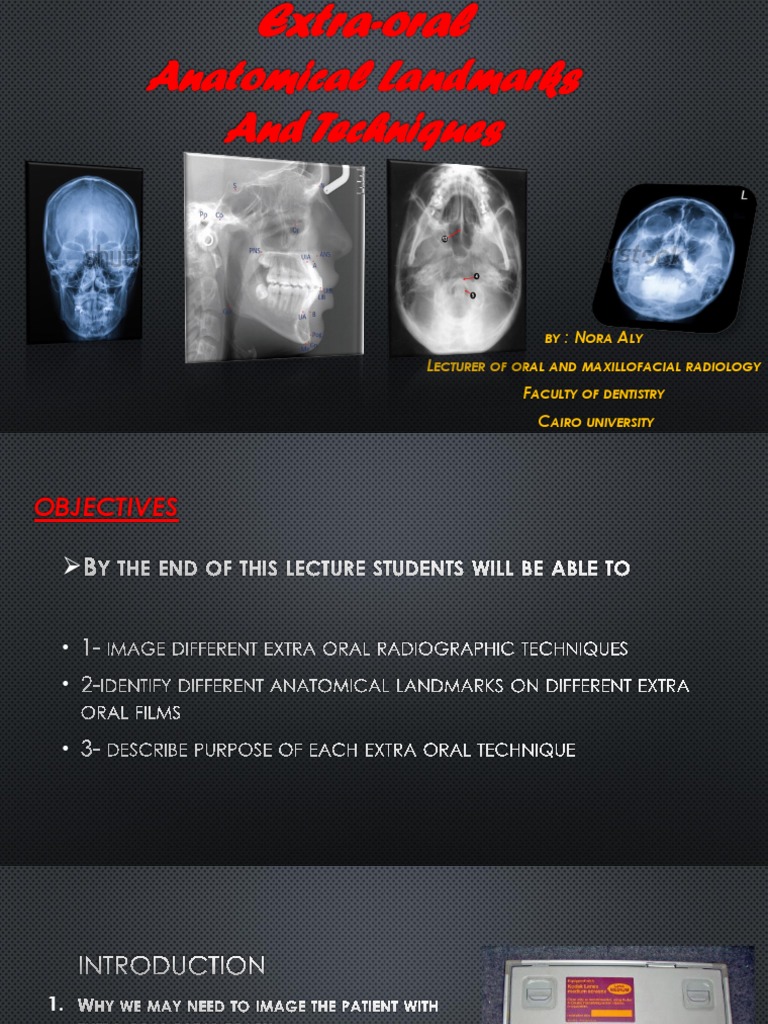 A Guide to Extra-oral Anatomical Landmarks and Radiographic Techniques ...