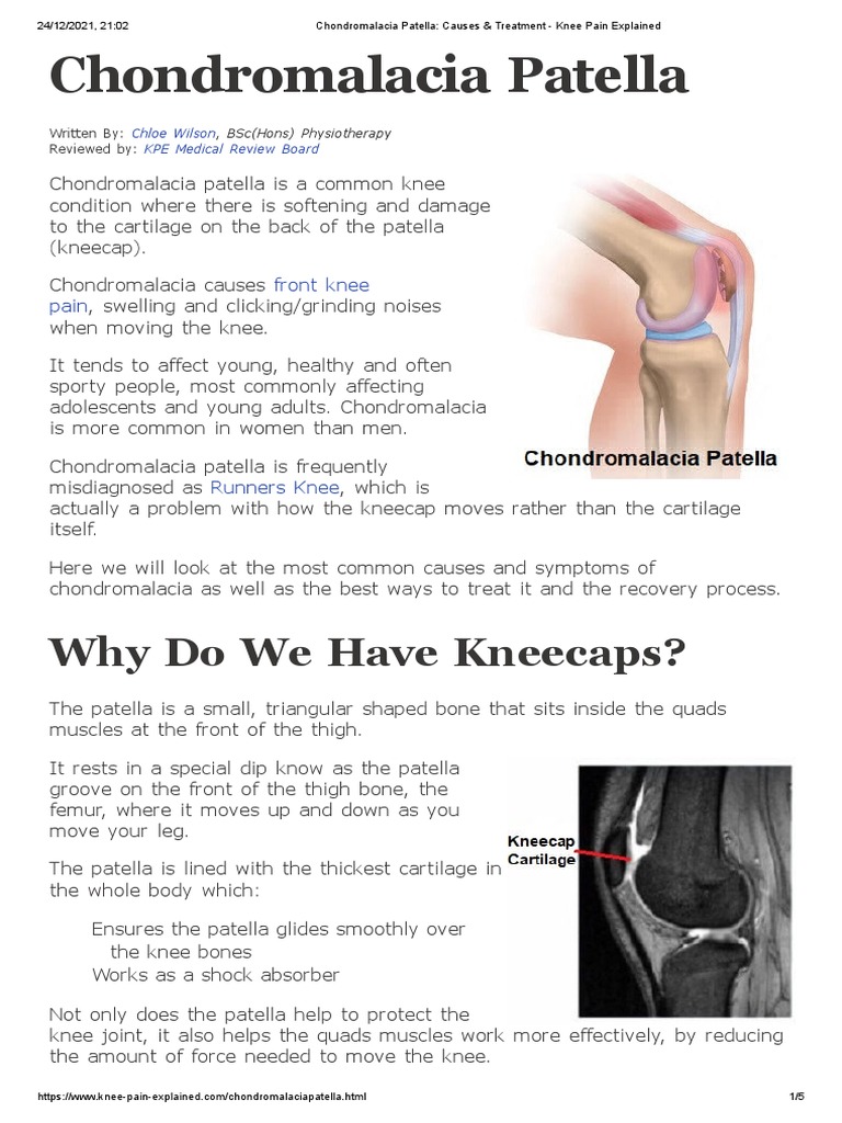 Chondromalacia Patella: Causes & Treatment | PDF | Knee | Limbs (Anatomy)