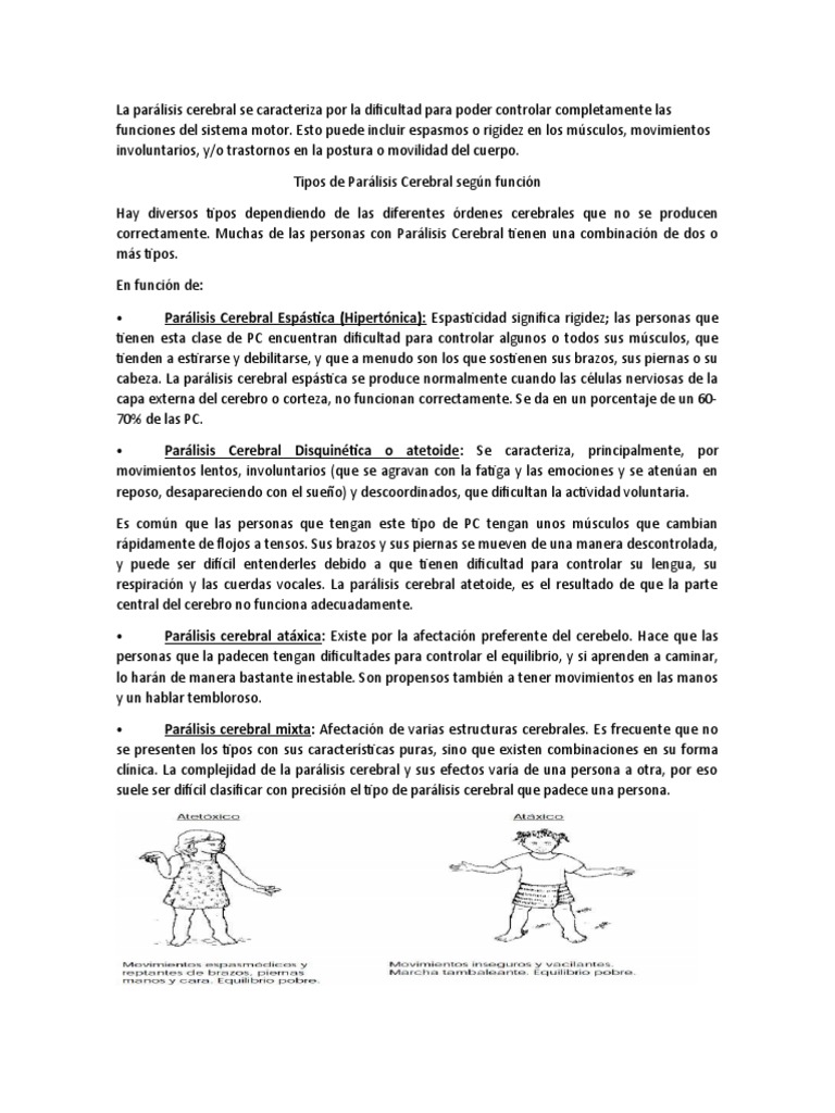La Parálisis Cerebral Se Caracteriza Por La Dificultad para Poder ...