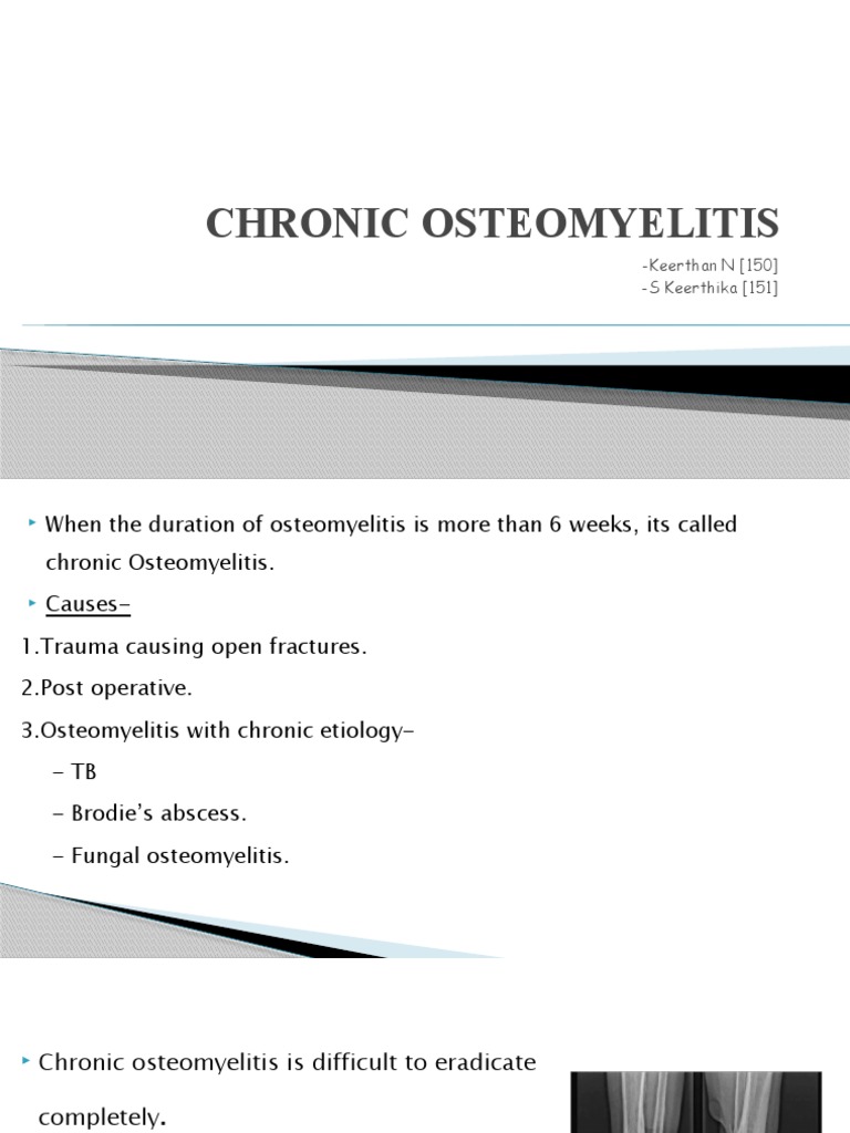 Chronic Osteomyelitis Overview and Management | PDF | Causes Of Death ...