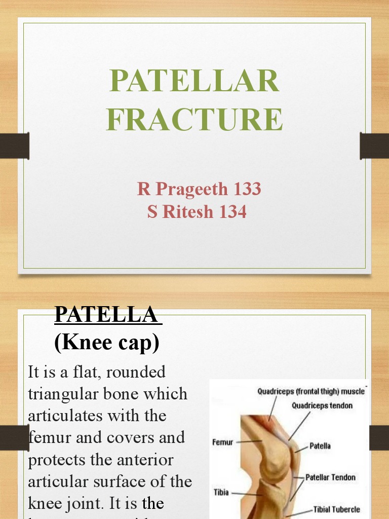 Patellar Fracture Classification and Management | PDF | Wellness ...