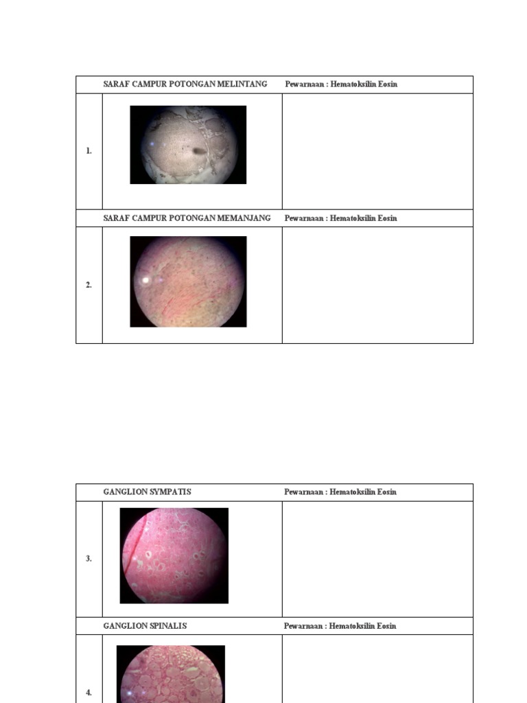 TP 3 Histologi - Jaringan Saraf Dan Limfoid | PDF