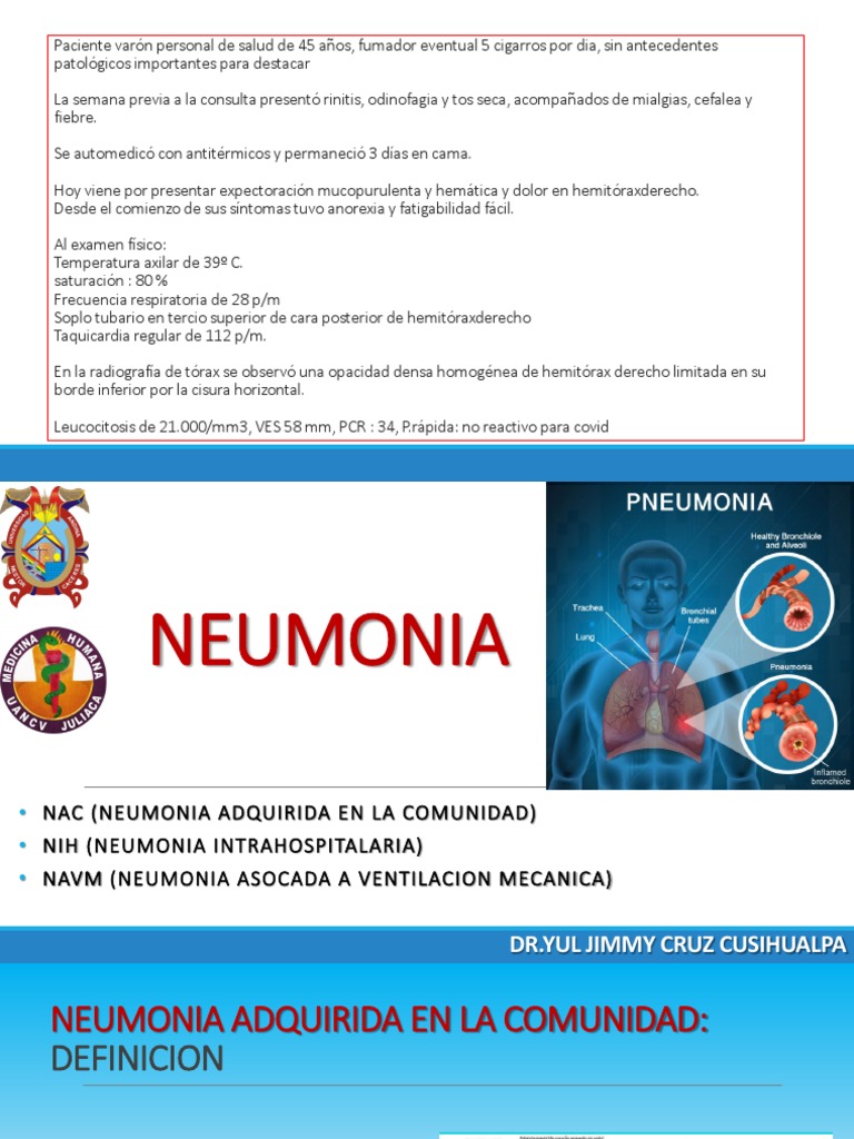 Neumonia - Uancv | PDF | Neumonía | Inmunología