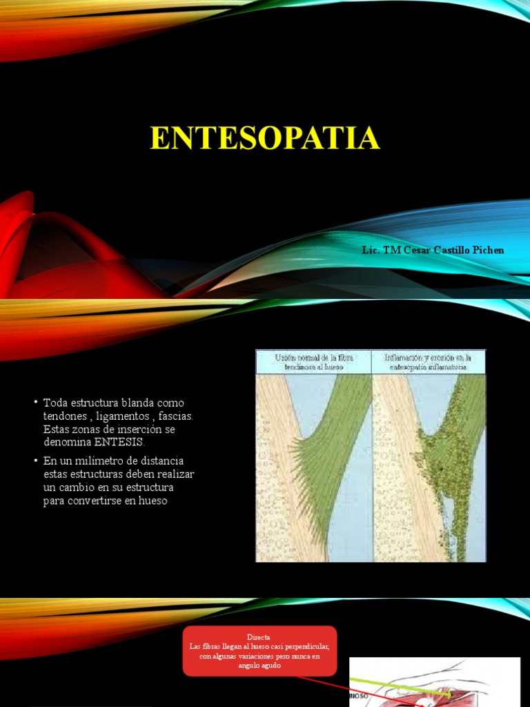 Entesopatia | PDF | Hombro | Articulación