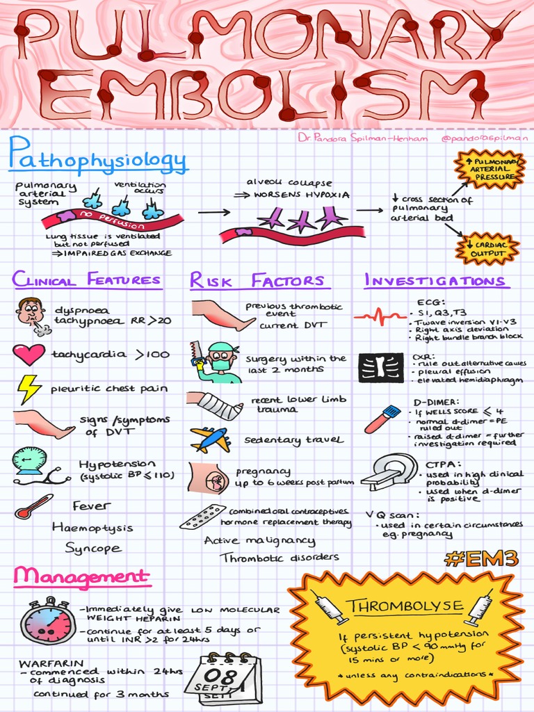 Pulmonary Embolism (Infographic) | PDF