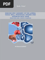 Step-by-Step FESS Surgical Guide | PDF | Human Nose | Human Head And Neck