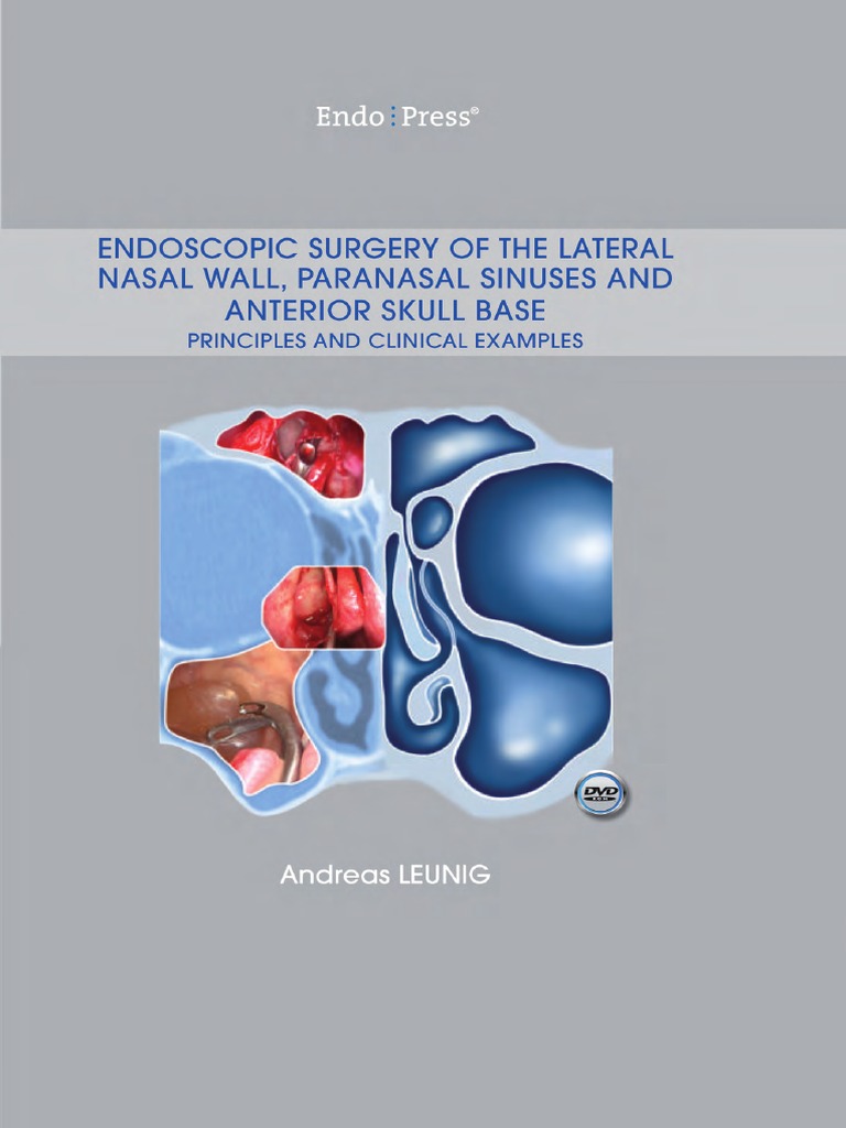 Endoscopic Surgery of The Lateral Nasal Wall, Paranasal Sinuses, and ...