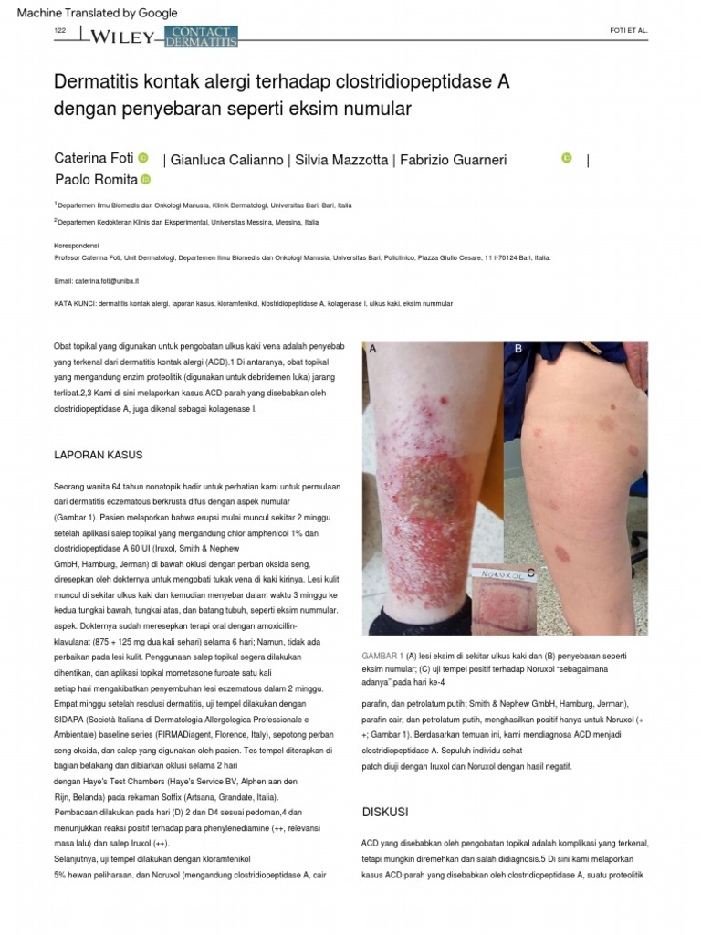Dermatitis Kontak Alergi Terhadap Clostridiopeptidase A Dengan Penyebaran Seperti Eksim Numular ...